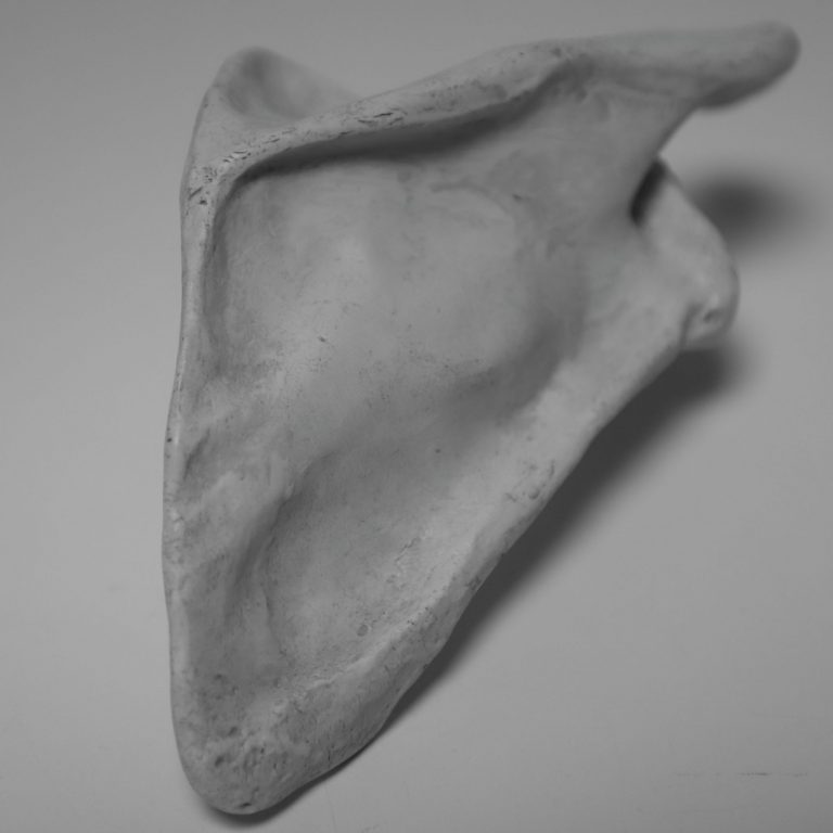 Frozen Shoulder | Wat is het? | Wat kan ik zelf doen?